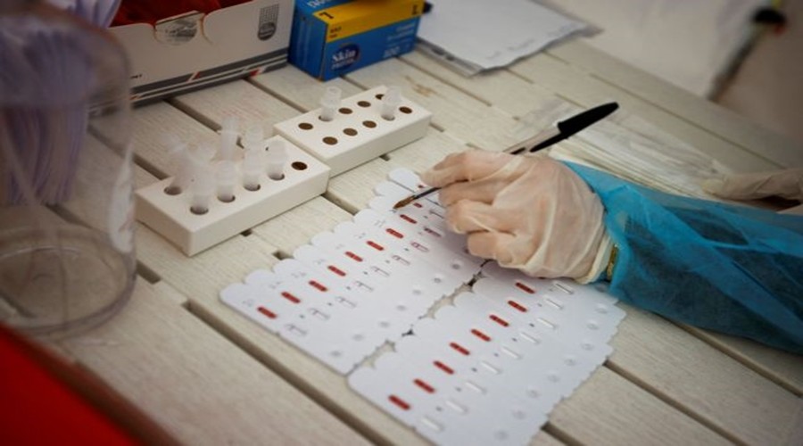 OΜΙΚΡΟΝ – ΓΙΑΤΙ ΤΟ RAPID TEST ΒΓΑΙΝΕΙ ΑΡΝΗΤΙΚΟ ΣΤΟΝ ΚΟΡΟΝΑΪΟ ΚΑΙ ΤΟ PCR ...